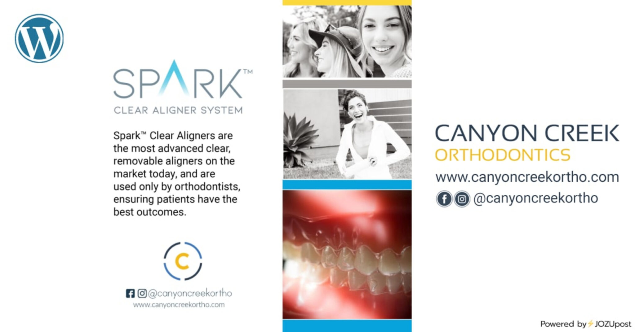 Spark Are The Most Advanced Clear Removable Aligners On The Market ...