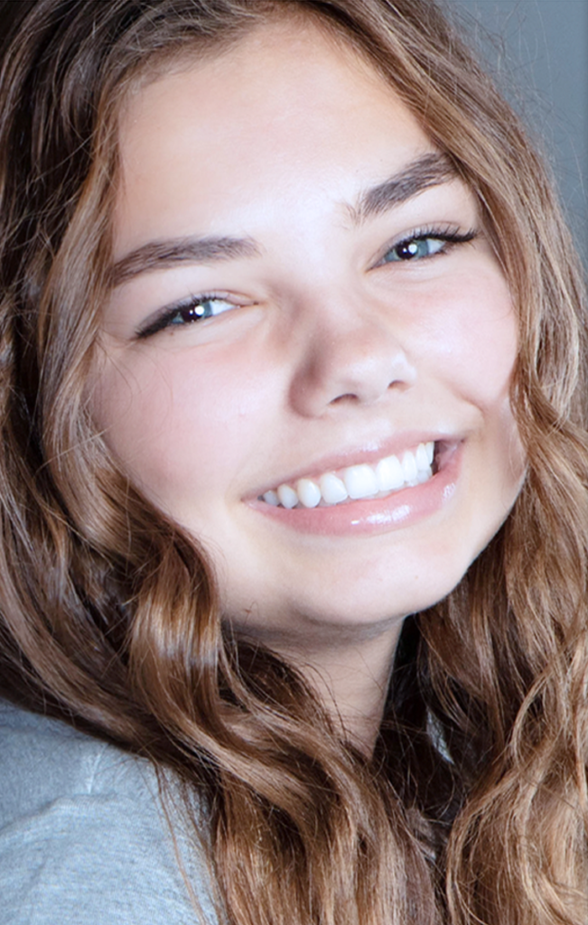 Damon® Clear Braces – Canyon Creek Orthodontics