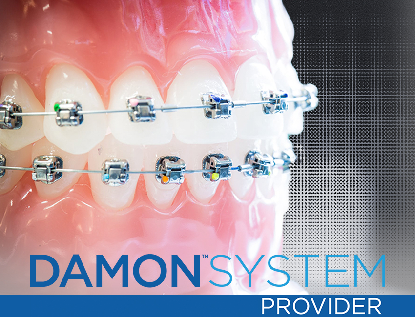 Damon® Metal Braces – Canyon Creek Orthodontics