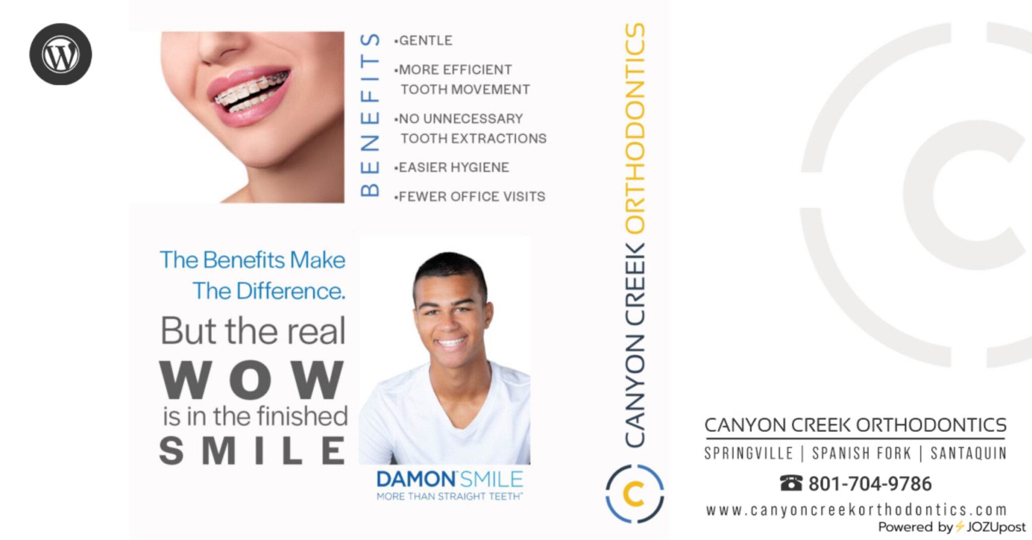 DAMON™ SYSTBM BENEFITS – Canyon Creek Orthodontics