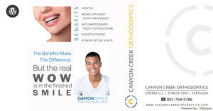 DAMON™ SYSTBM BENEFITS – Canyon Creek Orthodontics